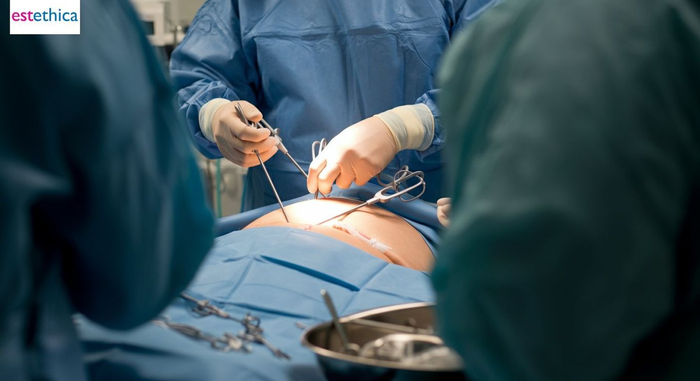 Mastering Bariatric Surgery: Essential Insights
